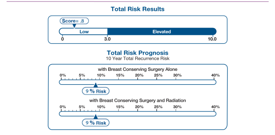 A New Bio-marker Test for DCIS = Peace of Mind for Thousands of Women ...